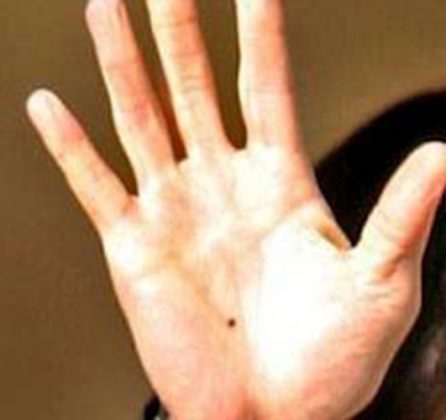 This Is What It Means If You Have A Mole On One Of These 7 Places On ...
