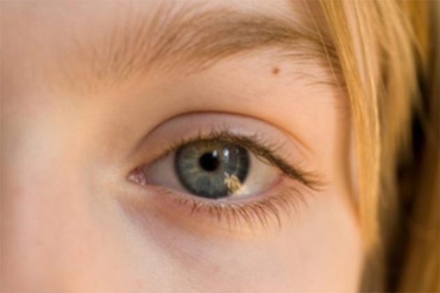 This Is What It Means If You Have A Mole On One Of These 7 Places On ...