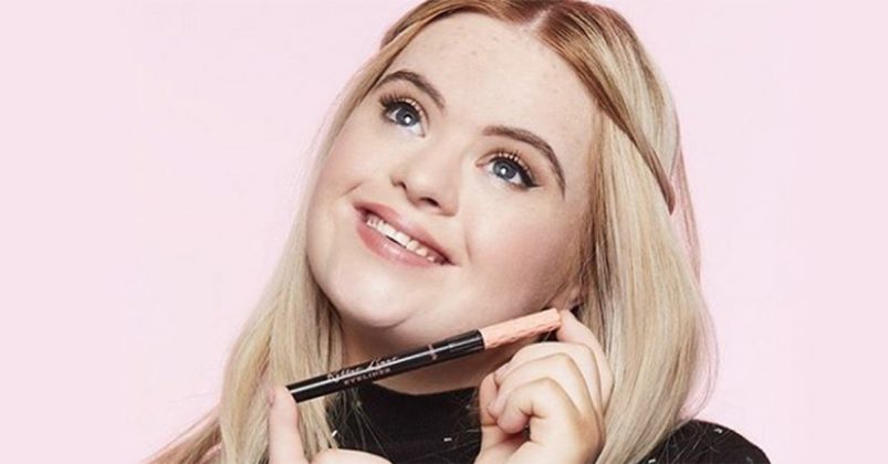 Young Model With Down Syndrome Chosen As New Face For Cosmetic Brand